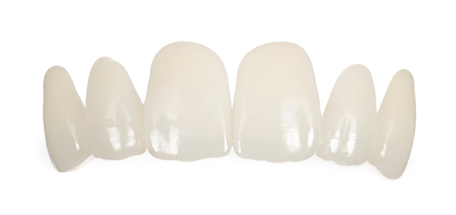IPS e.max - R-Dent