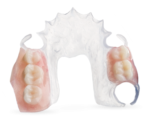 Acrylic Partial – R-Dent Dental Laboratory