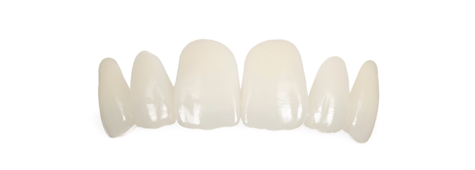 IPS e.max – R-Dent Dental Laboratory
