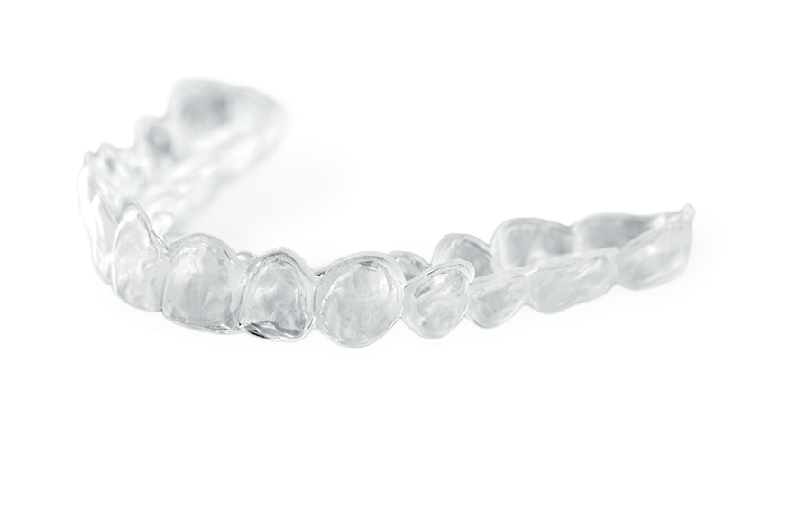 Bleaching Tray – R-Dent Dental Laboratory